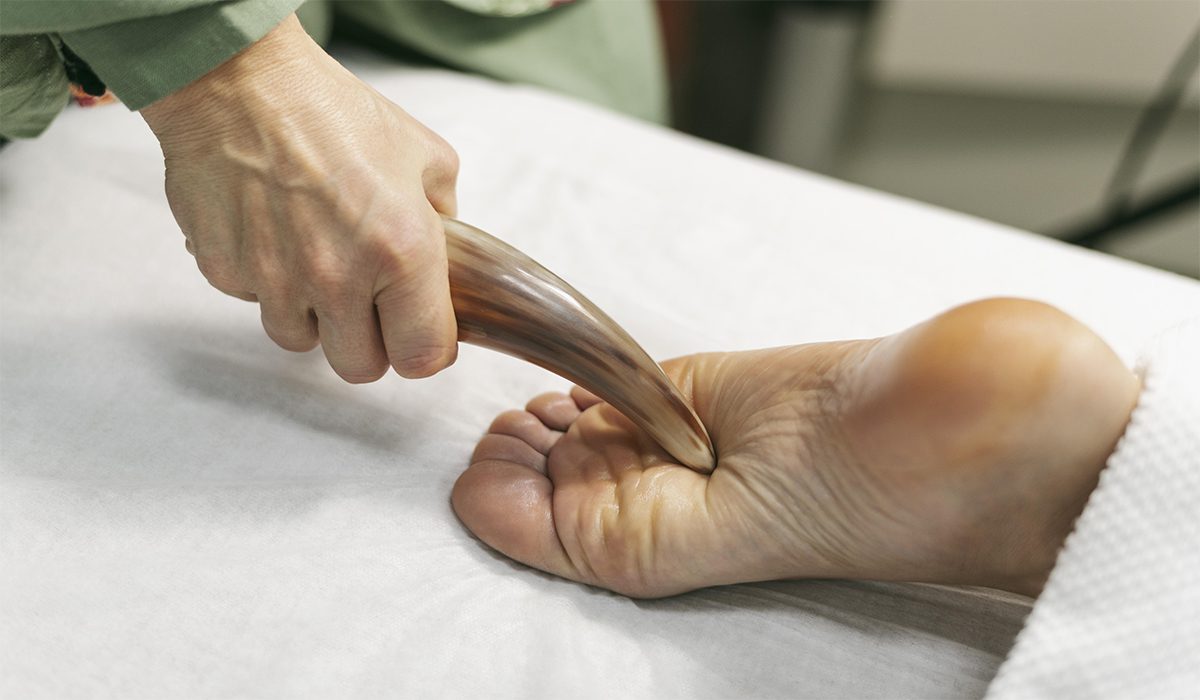 Heel Spurs: Causes, Symptoms, and Treatments