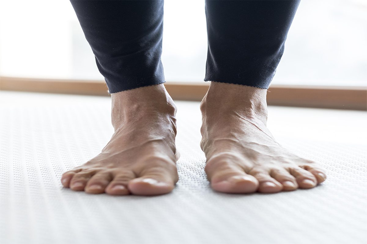 Flat Feet: Causes, Symptoms, and Treatments